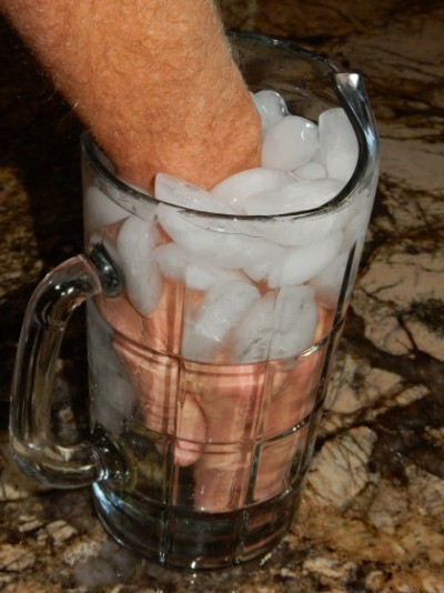 Ice or Heat for Carpal Tunnel? - The Carpal Solution