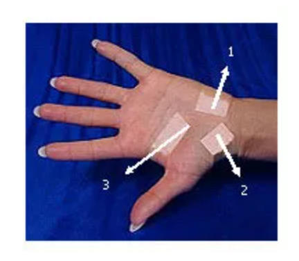 How the Carpal Solution Works: Natural Carpal Tunnel Relief