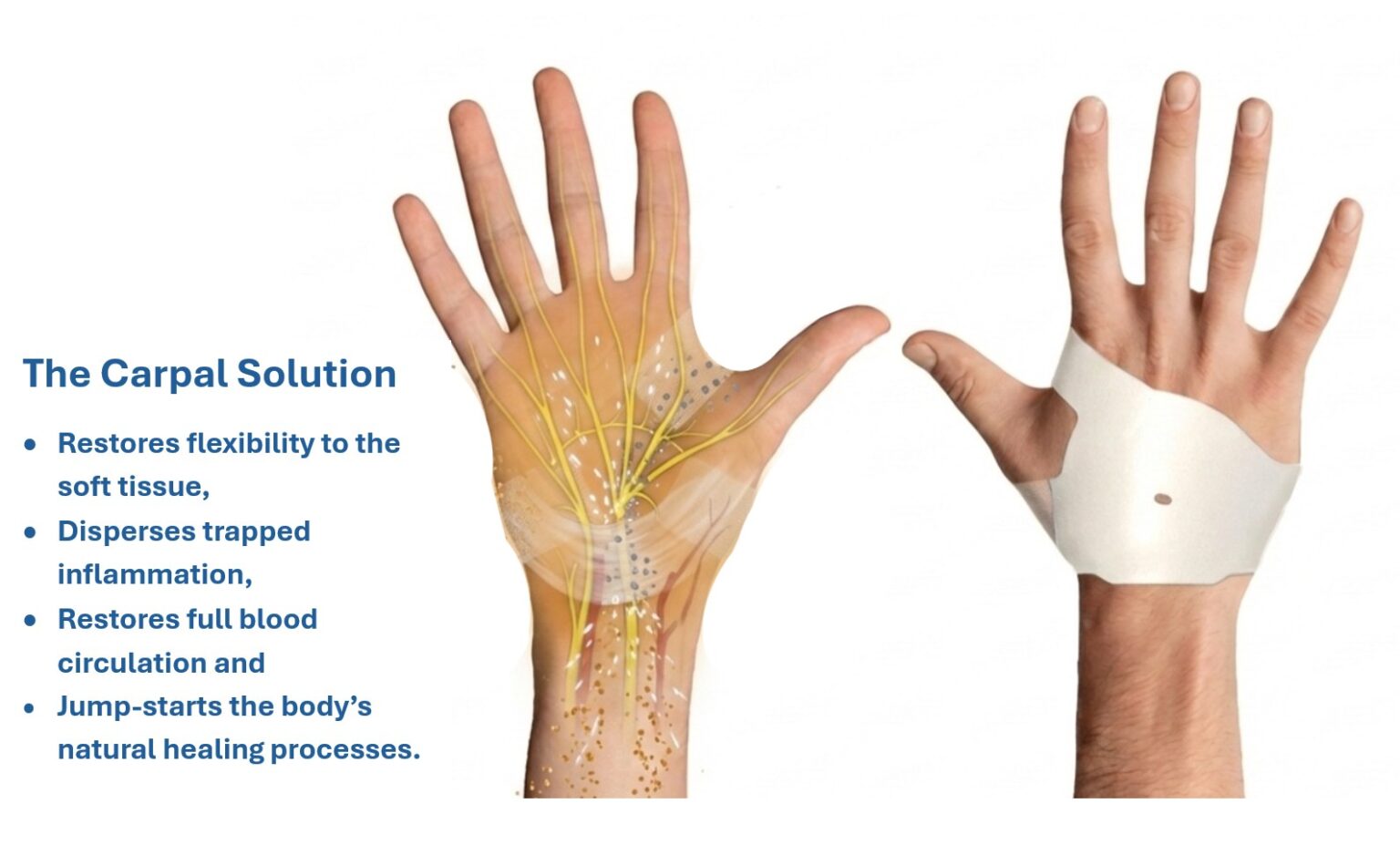 Natural Carpal Tunnel Relief: Clinically Proven Treatment